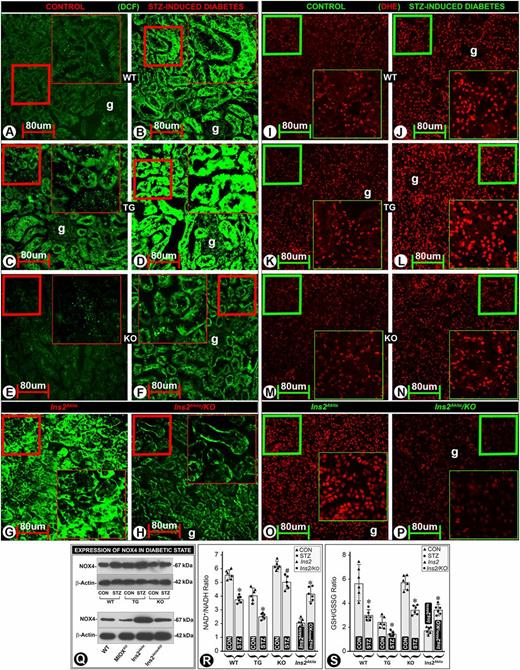 Myo-inositol Oxygenase (MIOX) Overexpression Drives the Progression of ...