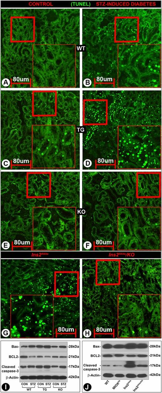 Myo-inositol Oxygenase (MIOX) Overexpression Drives the Progression of ...