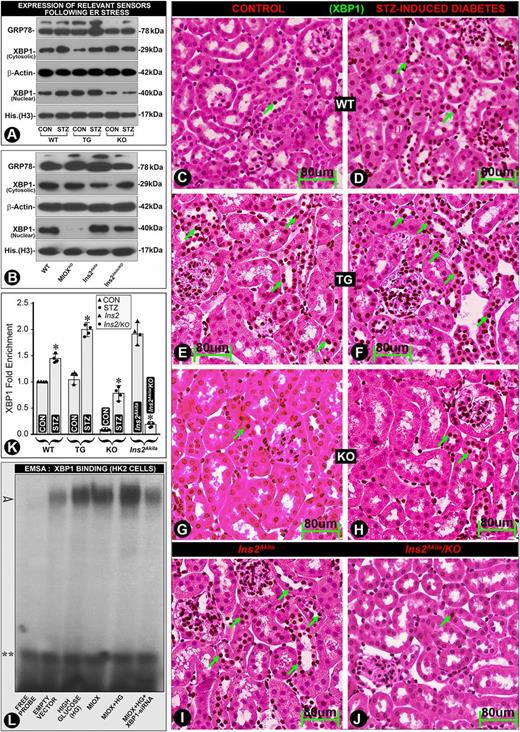 Myo-inositol Oxygenase (MIOX) Overexpression Drives the Progression of ...