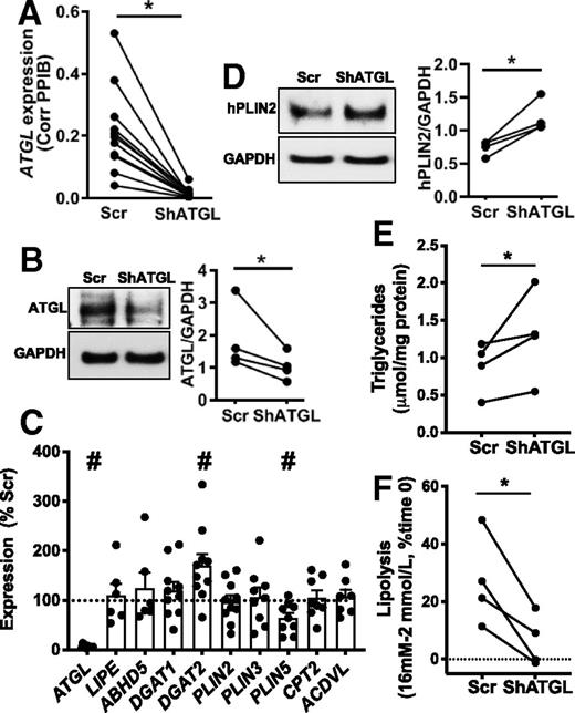 Adipose Triglyceride Lipase Is a Key Lipase for the Mobilization of ...
