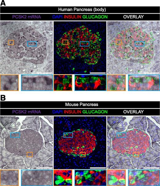 Revisiting Proinsulin Processing: Evidence That Human β-Cells Process ...