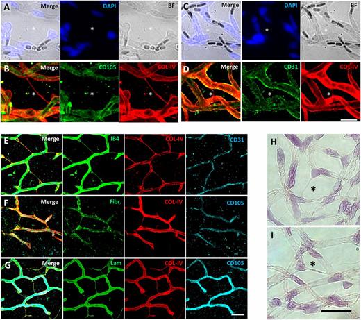 Pericyte Bridges in Homeostasis and Hyperglycemia | Diabetes | American ...
