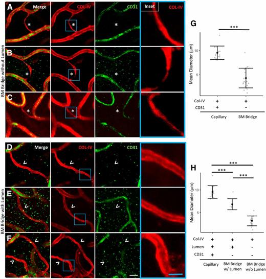 Pericyte Bridges in Homeostasis and Hyperglycemia | Diabetes | American ...