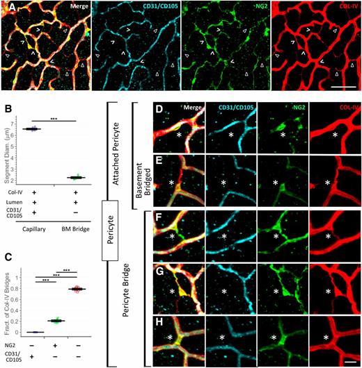 Pericyte Bridges in Homeostasis and Hyperglycemia | Diabetes | American ...