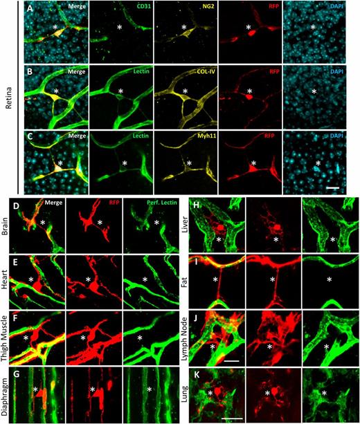 Pericyte Bridges in Homeostasis and Hyperglycemia | Diabetes | American ...