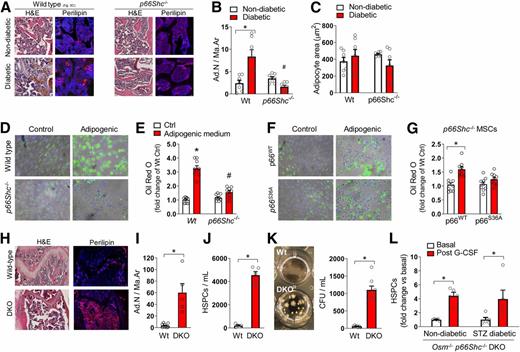 Pharmacologic PPAR-γ Activation Reprograms Bone Marrow Macrophages and ...