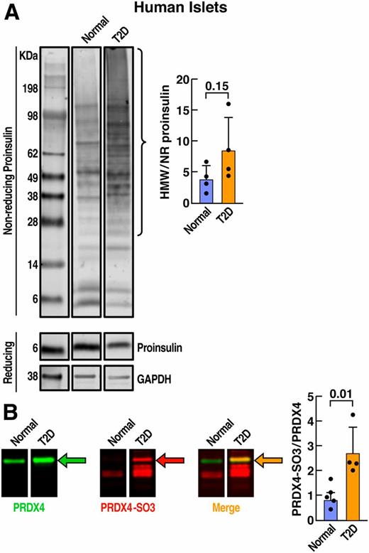 Unbiased Profiling of the Human Proinsulin Biosynthetic Interaction Network Reveals a Role for ...