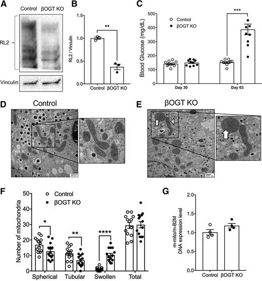 OGT Regulates Mitochondrial Biogenesis and Function via Diabetes ...