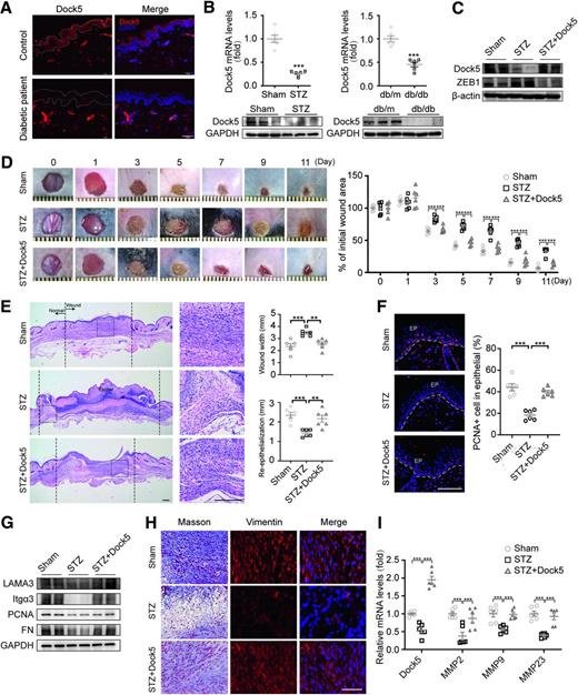 Dedicator of Cytokinesis 5 Regulates Keratinocyte Function and Promotes ...