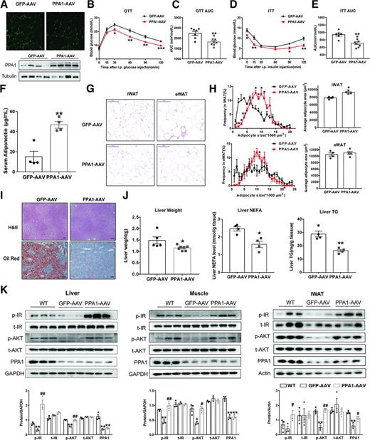 PPA1 Regulates Systemic Insulin Sensitivity by Maintaining Adipocyte ...