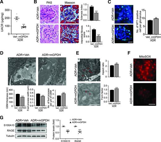 Deficiency of Mitochondrial Glycerol 3-Phosphate Dehydrogenase ...