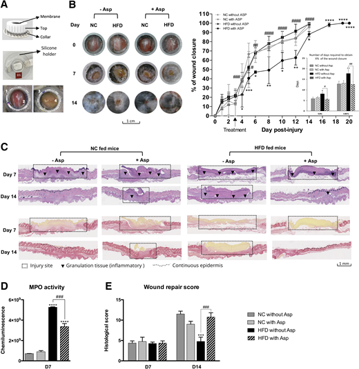 Topical Aspirin Administration Improves Cutaneous Wound Healing in ...