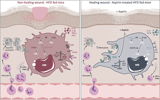 Topical Aspirin Administration Improves Cutaneous Wound Healing in ...