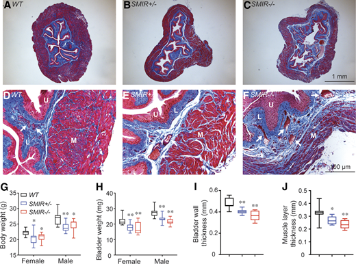 Smooth Muscle Insulin Receptor Deletion Causes Voiding Dysfunction: A ...