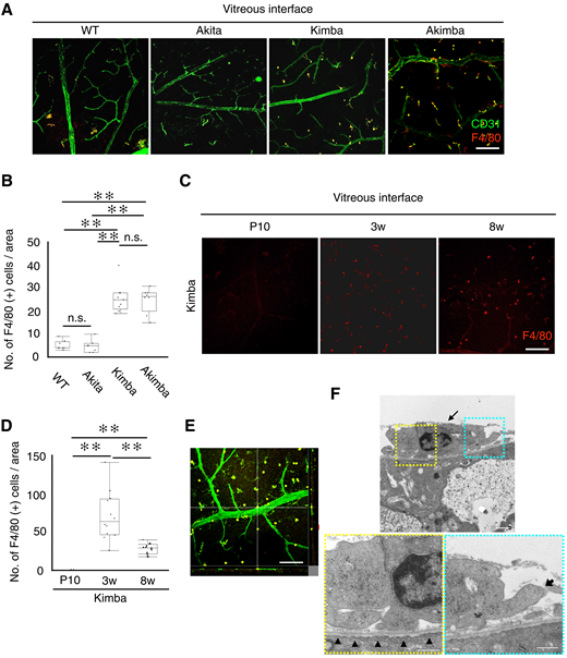 Identifying Hyperreflective Foci in Diabetic Retinopathy via VEGF ...