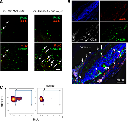 Identifying Hyperreflective Foci in Diabetic Retinopathy via VEGF ...