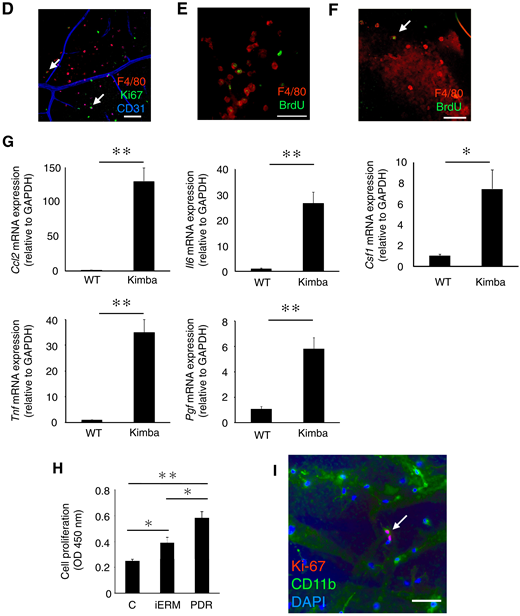 Identifying Hyperreflective Foci in Diabetic Retinopathy via VEGF ...