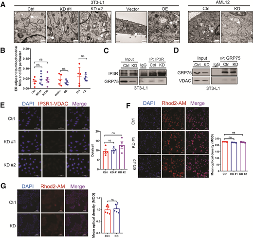GRP75 Regulates Mitochondrial-Supercomplex Turnover to Modulate Insulin ...