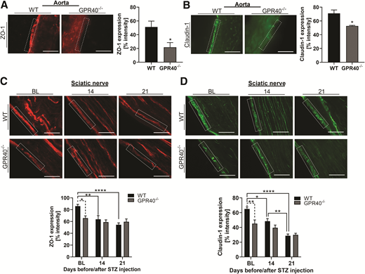 GPR40 Activation Abolishes Diabetes-Induced Painful Neuropathy by ...
