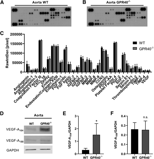 GPR40 Activation Abolishes Diabetes-Induced Painful Neuropathy by ...