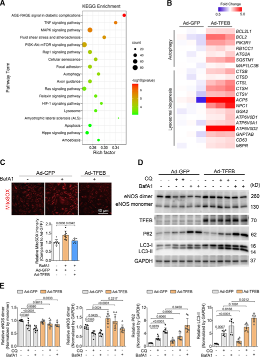 Restoration of Autophagic Flux Improves Endothelial Function in ...