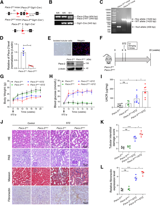 PACS-2 Ameliorates Tubular Injury by Facilitating Endoplasmic Reticulum ...