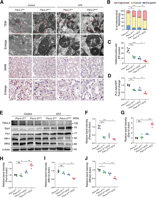 PACS-2 Ameliorates Tubular Injury by Facilitating Endoplasmic Reticulum ...