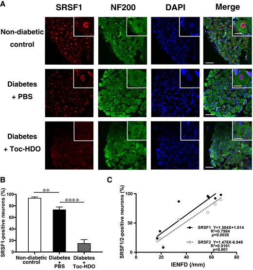 The Role of Long Noncoding RNA MALAT1 in Diabetic Polyneuropathy and ...
