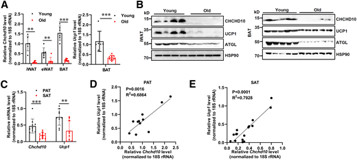 CHCHD10 Modulates Thermogenesis of Adipocytes by Regulating Lipolysis ...