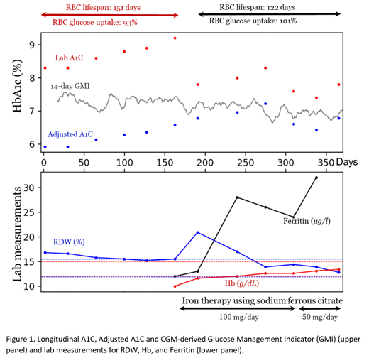 670-P: Iron-Deficiency Anemia Case Report Showing the Clinical ...