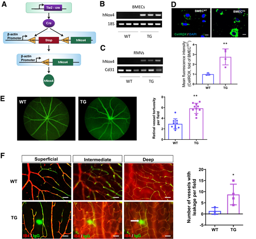 Sustained Upregulation of Endothelial Nox4 Mediates Retinal Vascular ...