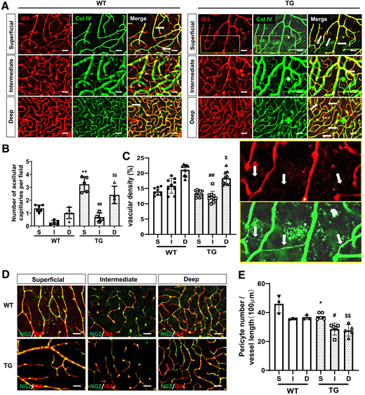Sustained Upregulation of Endothelial Nox4 Mediates Retinal Vascular ...