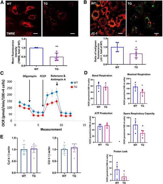 Sustained Upregulation of Endothelial Nox4 Mediates Retinal Vascular ...