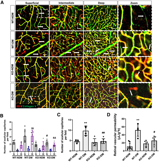 Sustained Upregulation of Endothelial Nox4 Mediates Retinal Vascular ...