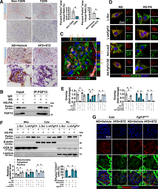 FGF13-Sensitive Alteration of Parkin Safeguards Mitochondrial ...