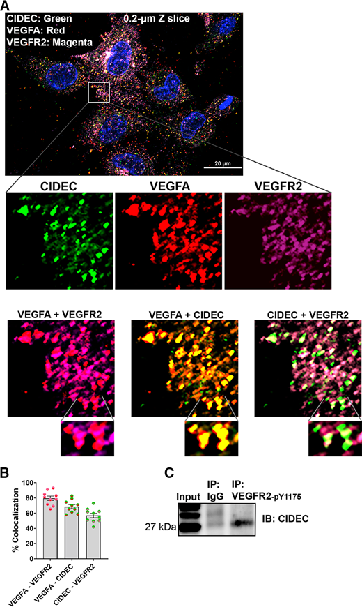Endothelial-Specific Expression of CIDEC Improves High-Fat Diet–Induced ...