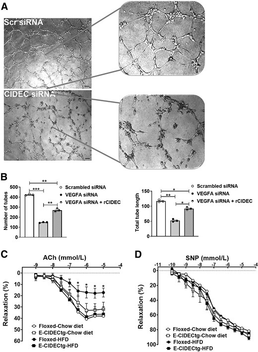Endothelial-Specific Expression of CIDEC Improves High-Fat Diet–Induced ...