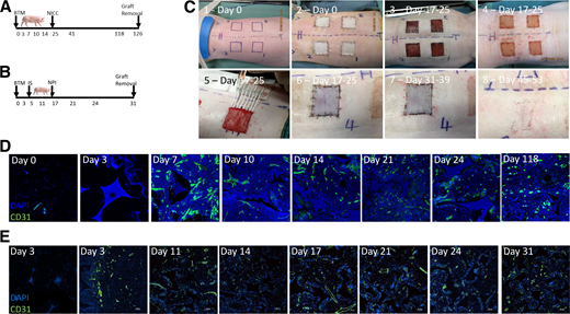 Intracutaneous Transplantation of Islets Within a Biodegradable ...