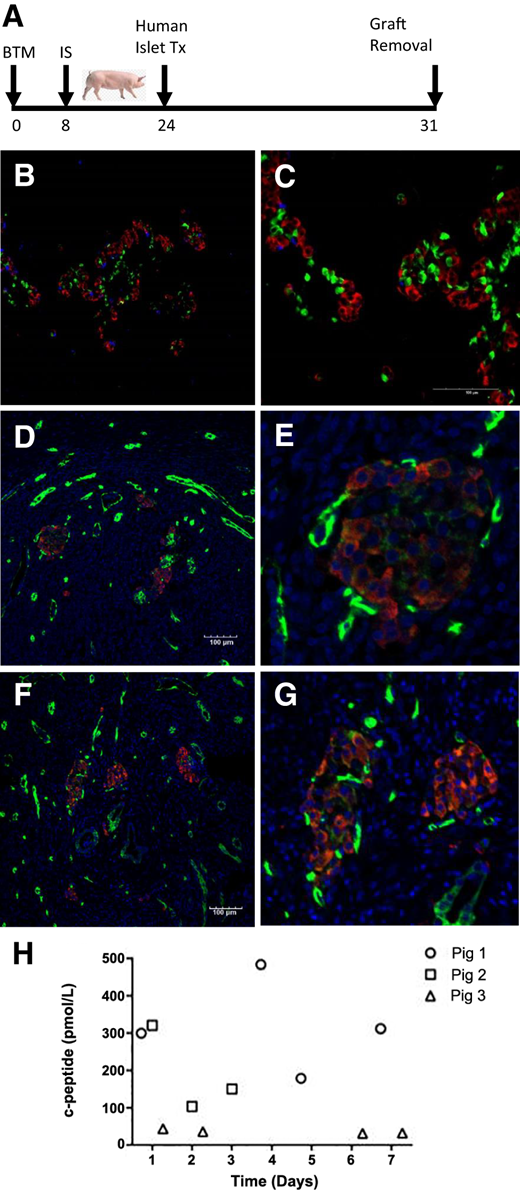 Intracutaneous Transplantation of Islets Within a Biodegradable ...