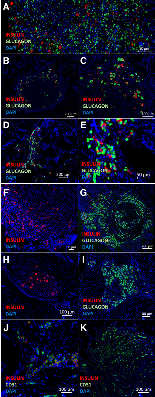 Intracutaneous Transplantation of Islets Within a Biodegradable ...