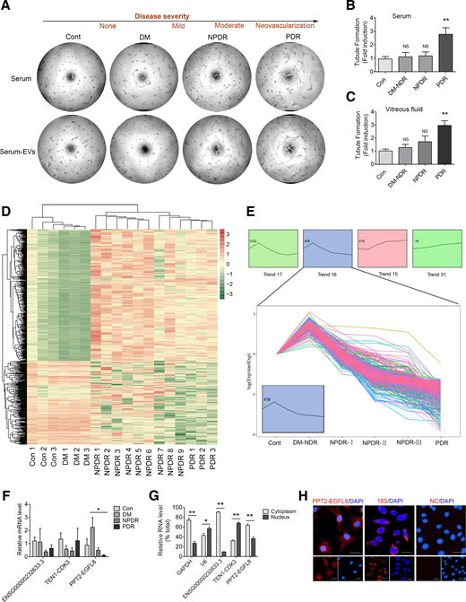 Long Noncoding RNA PPT2-EGFL8 Regulates Pathological Retinal ...