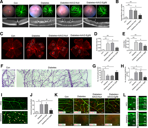 Long Noncoding RNA PPT2-EGFL8 Regulates Pathological Retinal ...