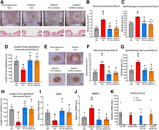 Reepithelialization of Diabetic Skin and Mucosal Wounds Is Rescued by ...