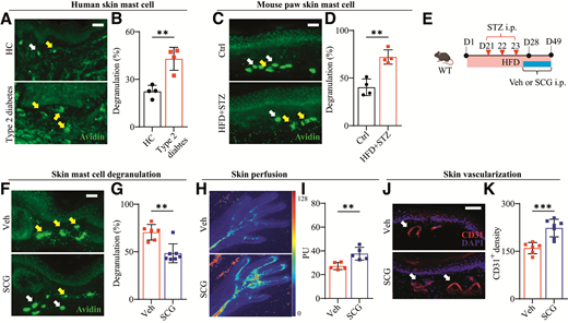 A Neuron–Mast Cell Axis Regulates Skin Microcirculation in Diabetes ...