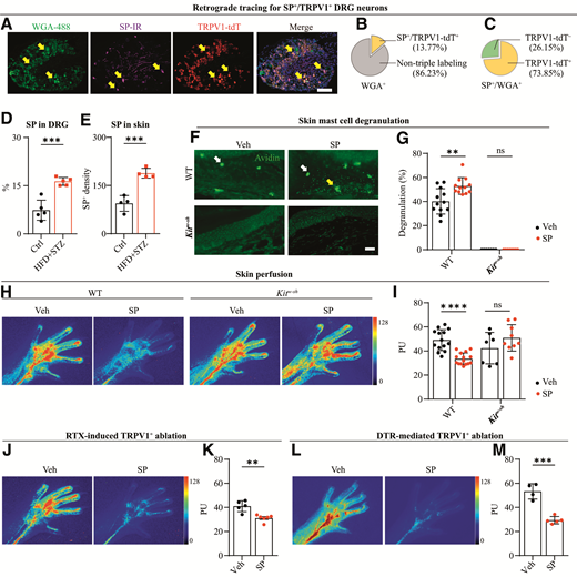 A Neuron–Mast Cell Axis Regulates Skin Microcirculation in Diabetes ...
