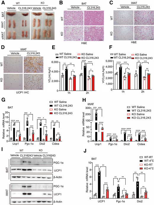 Foxj3 Regulates Thermogenesis of Brown and Beige Fat Via Induction of ...