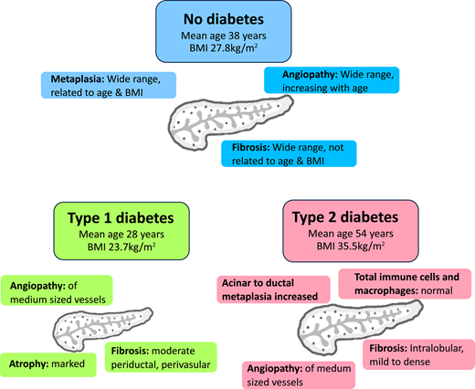 The Whole Human Pancreas: An Understudied Organ in Diabetes | Diabetes ...