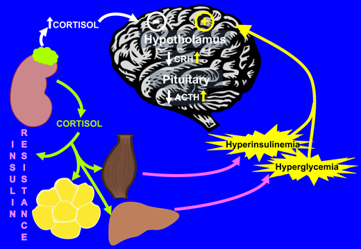 Cushing Syndrome, Hypercortisolism, and Glucose Homeostasis: A Review ...
