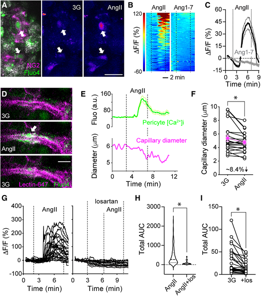 SARS-CoV-2 Spike S1 Subunit Triggers Pericyte and Microvascular ...