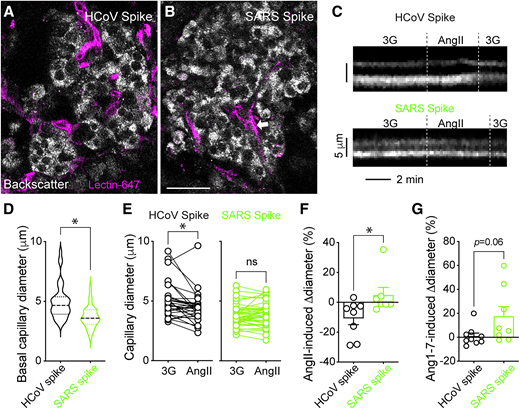 SARS-CoV-2 Spike S1 Subunit Triggers Pericyte and Microvascular ...